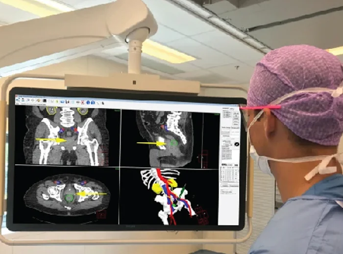 Get Best Navigation Guided Brain Surgery Outcomes - IBS Hospital